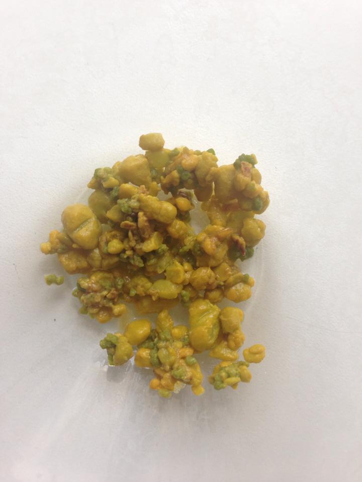 RENS DIN LEVER & SLIP VREDE OG FEDT: